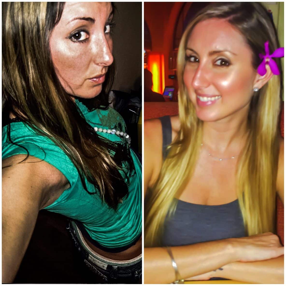 Drug and Alcohol Addiction: Before and After Photos and Stories
