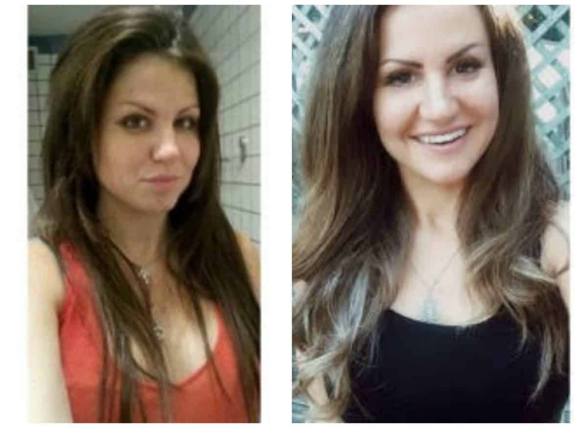 Drug and Alcohol Addiction: Before and After Photos and Stories