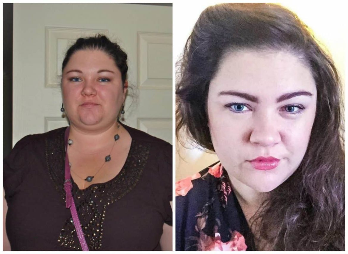 Drug and Alcohol Addiction: Before and After Photos and Stories